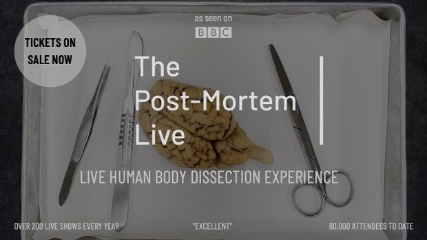 The Post-Mortem Live | Data Thistle